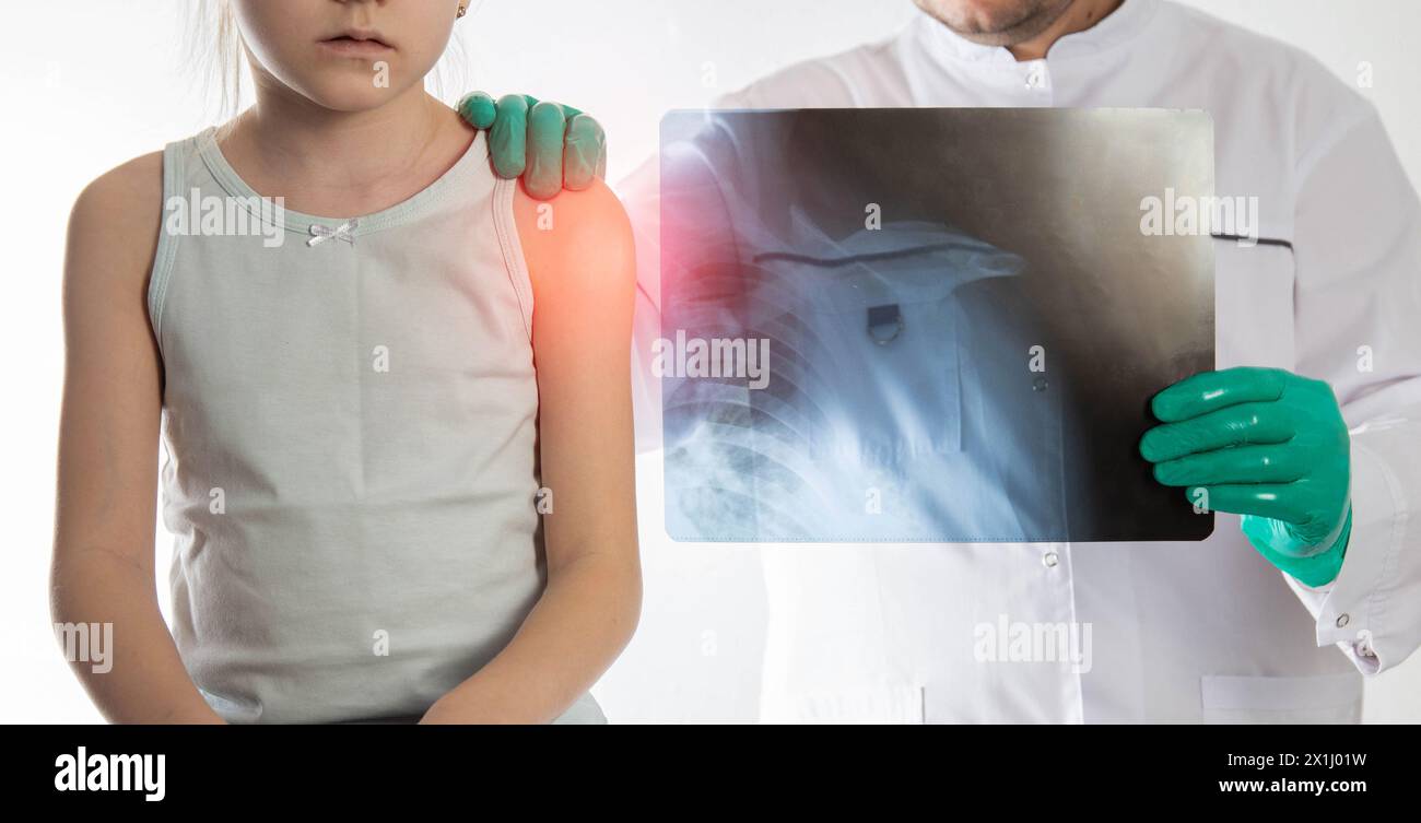 Dislocated shoulder hi-res stock photography and images - Alamy
