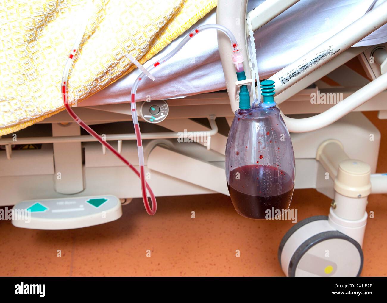 Woman gets a drain by a nurse in a hospital. The Netherlands ...
