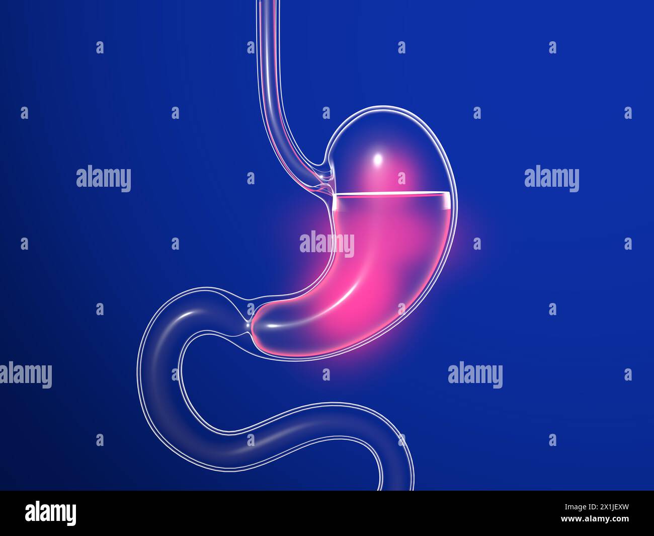 3D illustration of stomach with burning. Anatomical cut of transparent ...