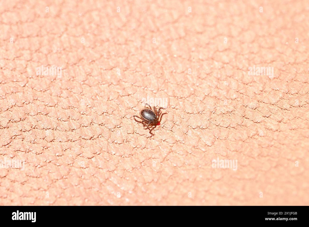 Human Skin Parasites