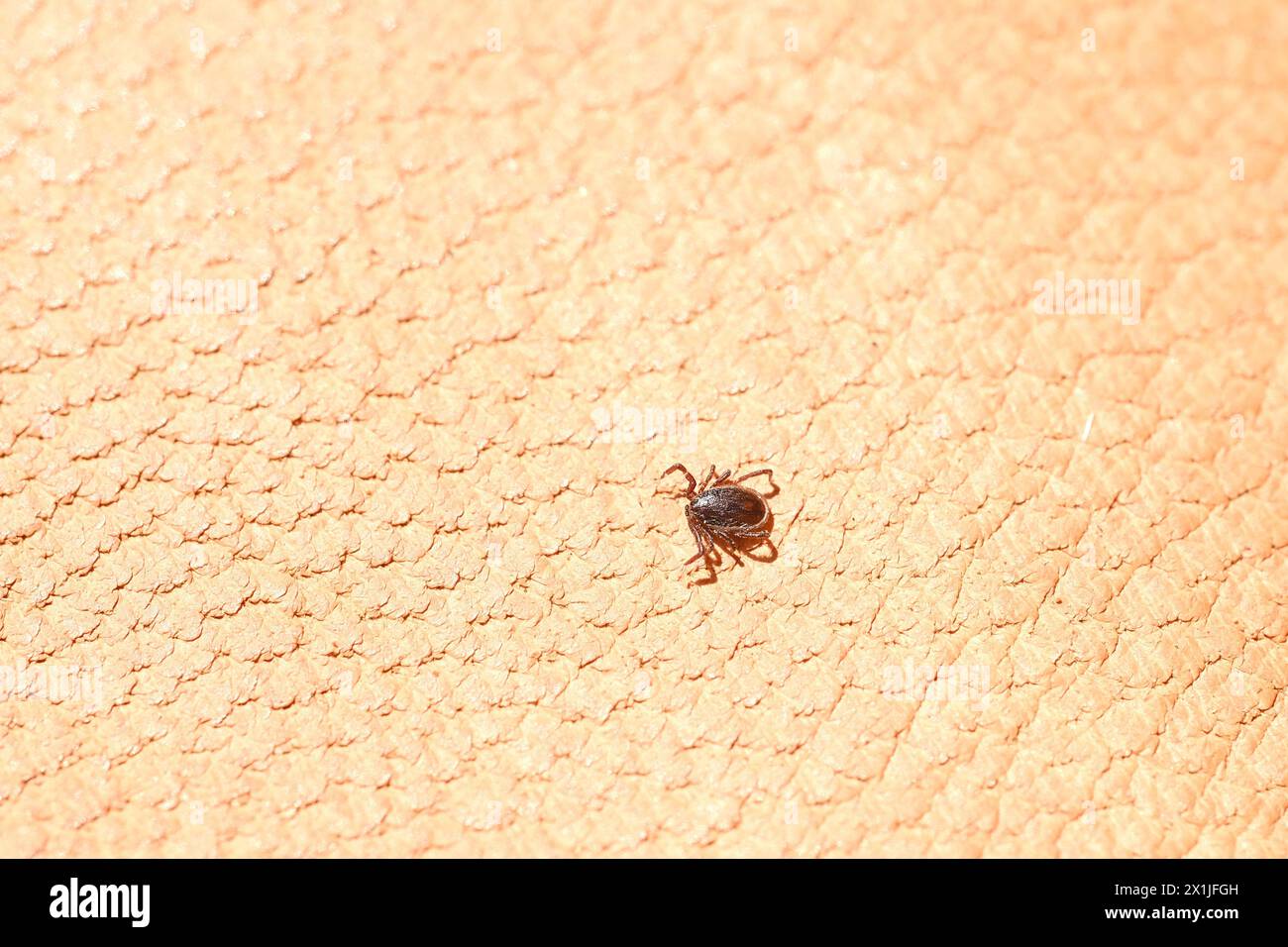 parasitiform tick from order Ixodidae, blood-sucking parasites on skin ...