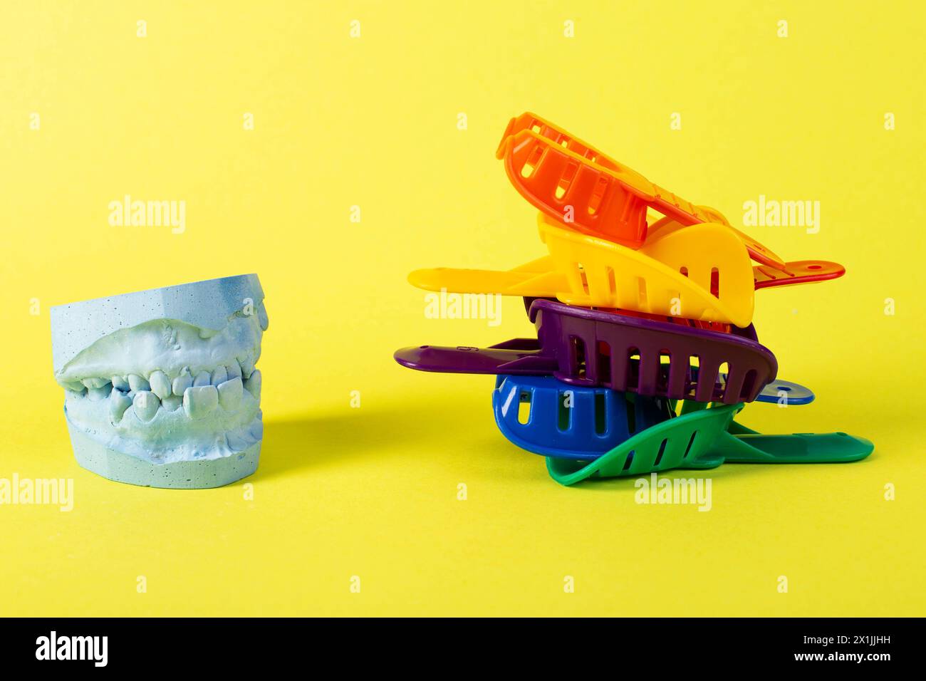 Blue plaster cast of a dental jaw and a dental tray for an impression ...