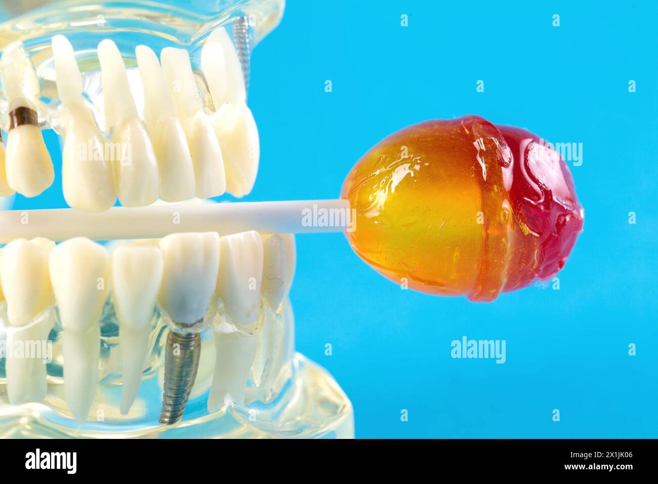 Candy on a stick in a tooth jaw mockup on a blue background. Concept of ...