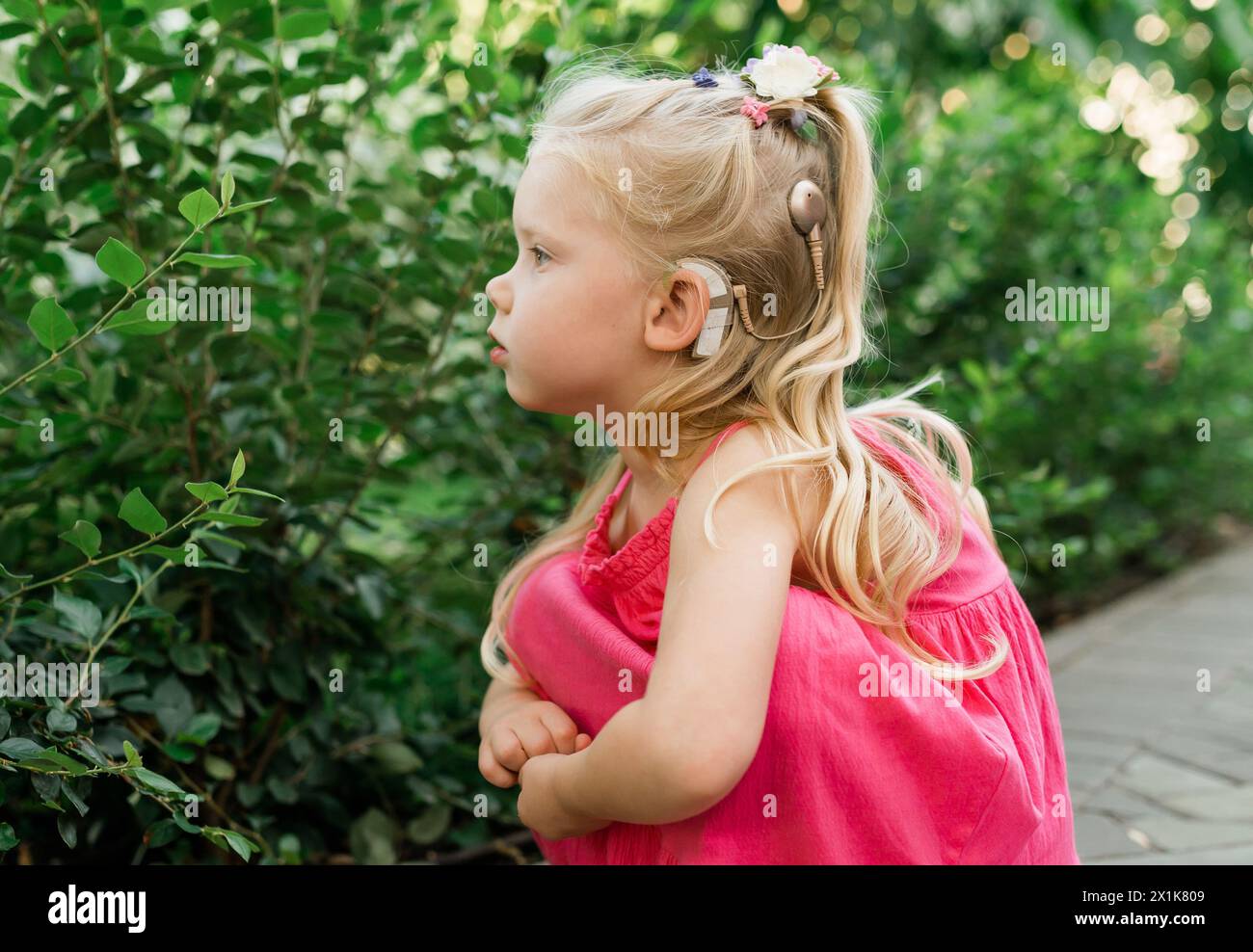 Child walks with cochlear implant system. Installation cochlear implant ...
