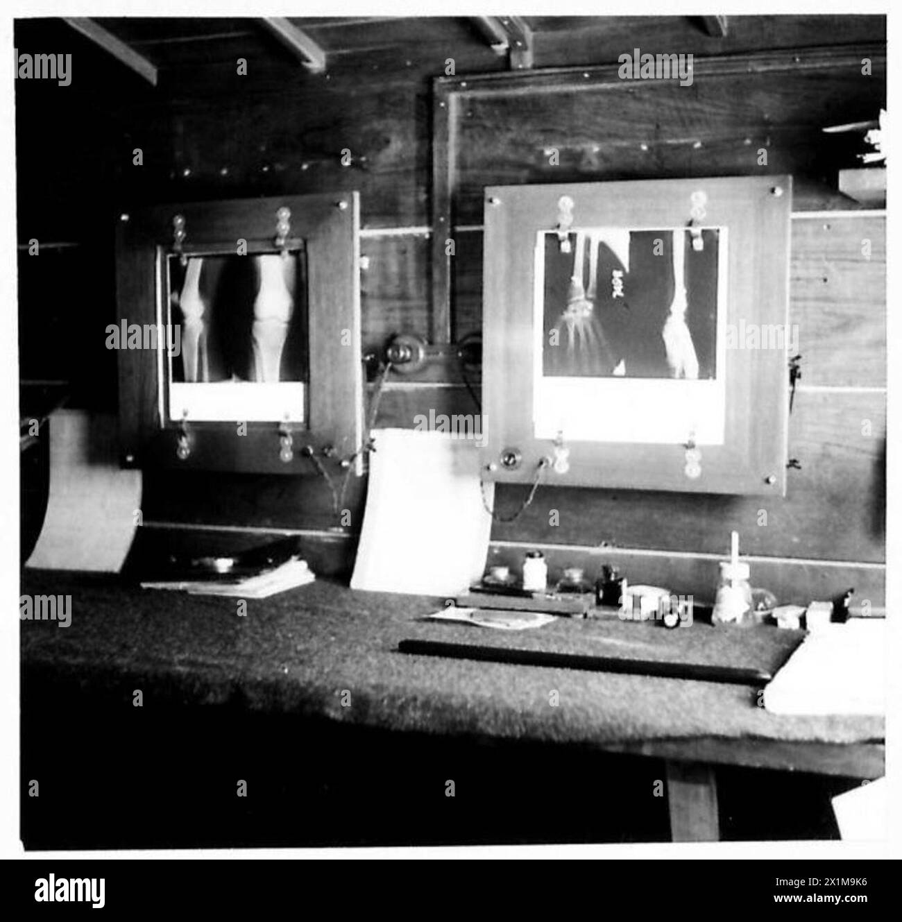 X ray photographs Cut Out Stock Images & Pictures - Alamy