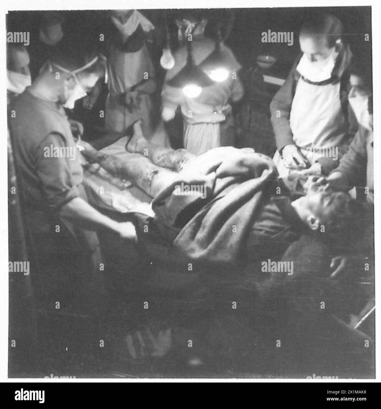 ITALY : FIFTH ARMYNURSES IN THE ANZIO BRIDGEHEAD - In the operating ...