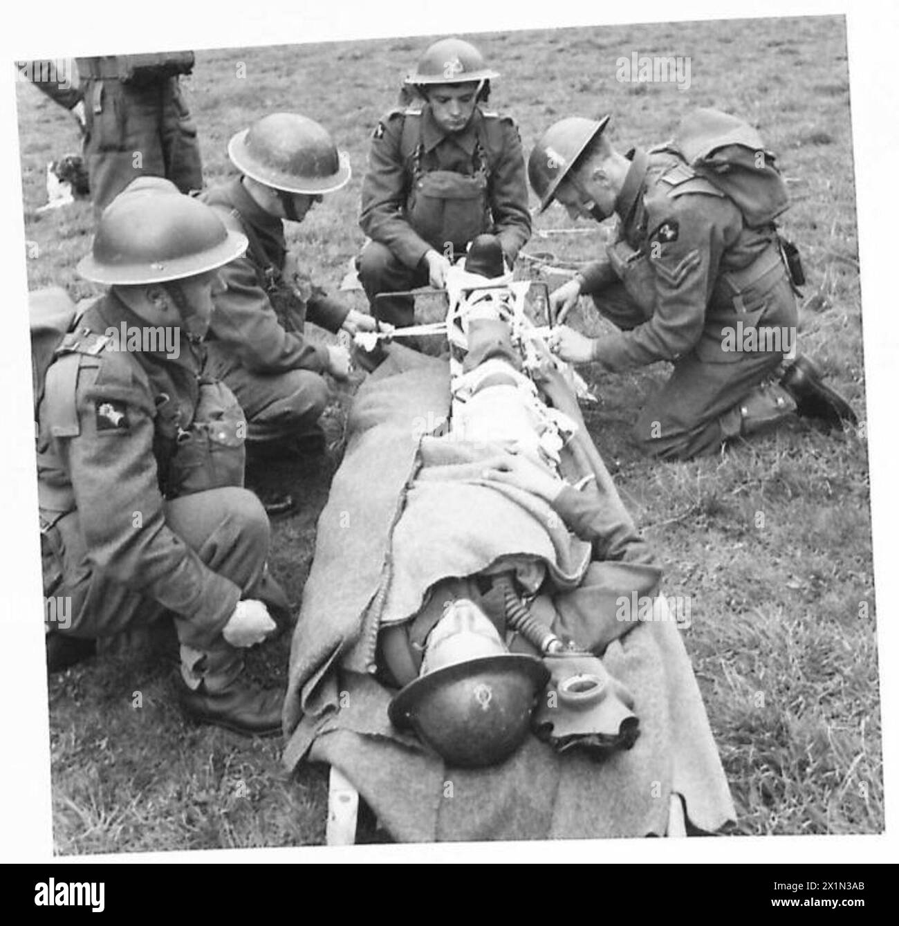 The British Army demonstrates the application of the Thomas splint in ...