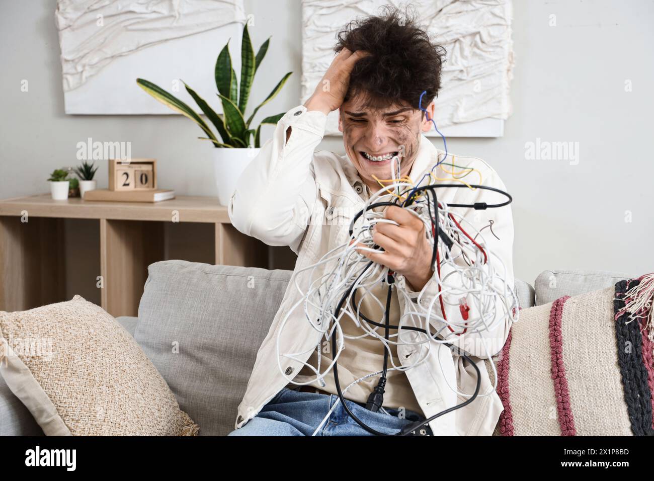 Electrical burn injury hi-res stock photography and images - Alamy