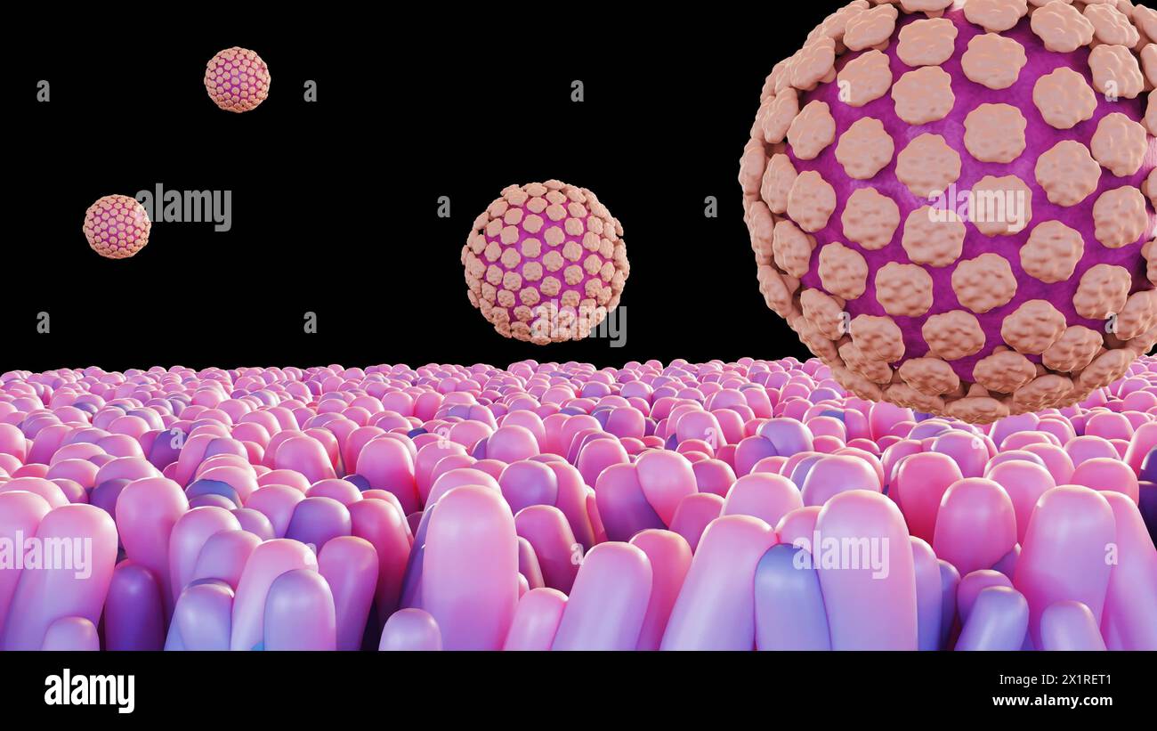 3d rendering of Norovirus is a highly contagious virus that causes ...