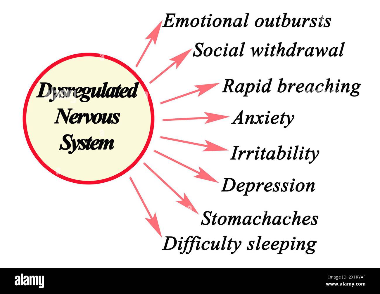 Effects of Dysregulated Nervous System Stock Photo - Alamy