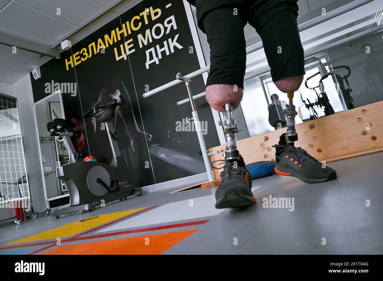 LVIV, UKRAINE - APRIL 17, 2024 - Osseointegrated prosthetic legs of ...