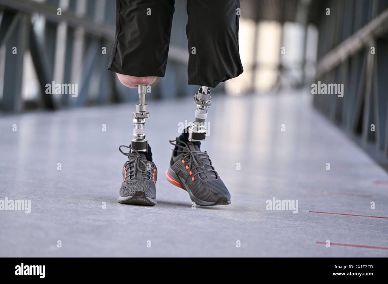 Non Exclusive: LVIV, UKRAINE - APRIL 17, 2024 - Osseointegrated ...