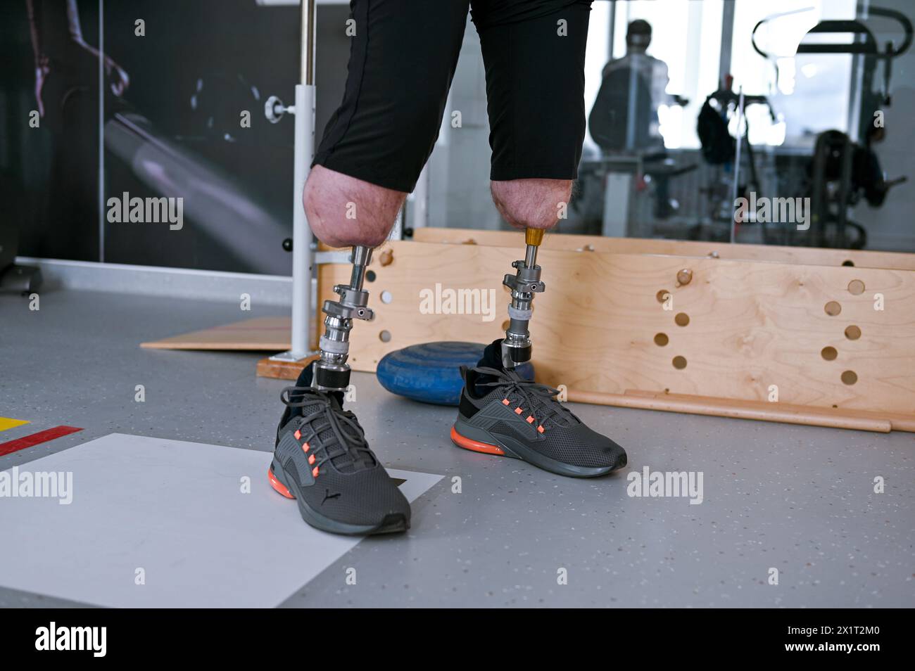 Non Exclusive: LVIV, UKRAINE - APRIL 17, 2024 - Osseointegrated ...