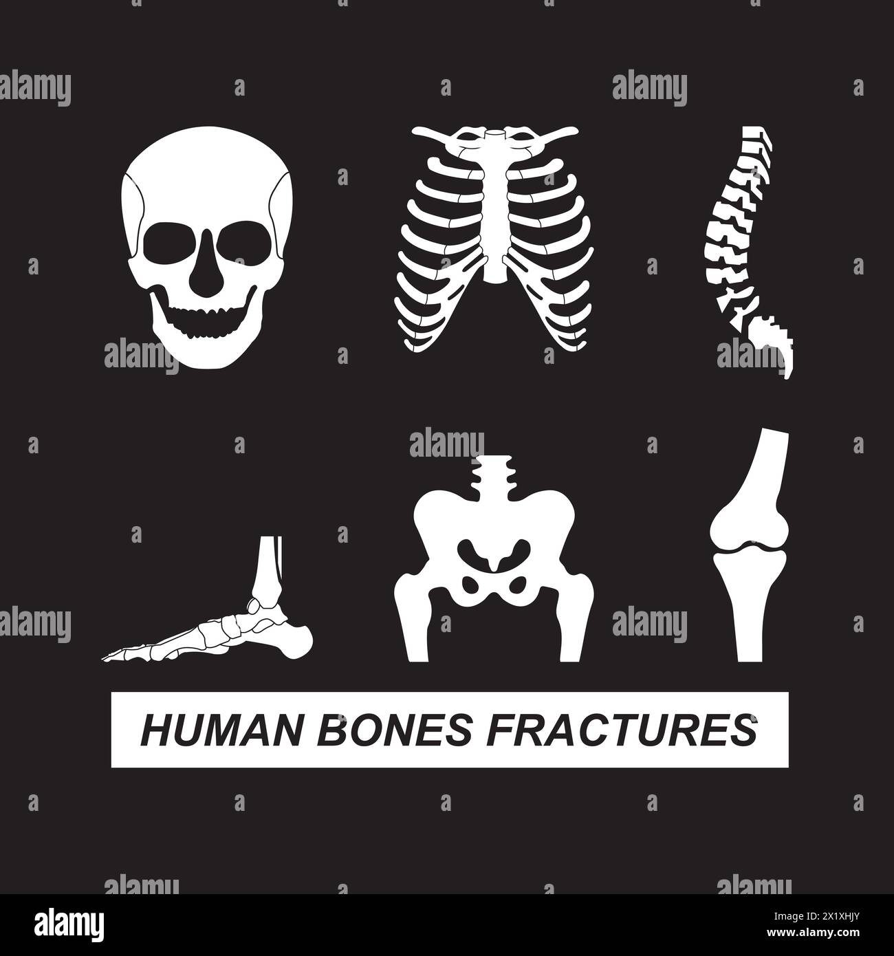 Human bones fractures icon vector symbol design Stock Vector Image ...