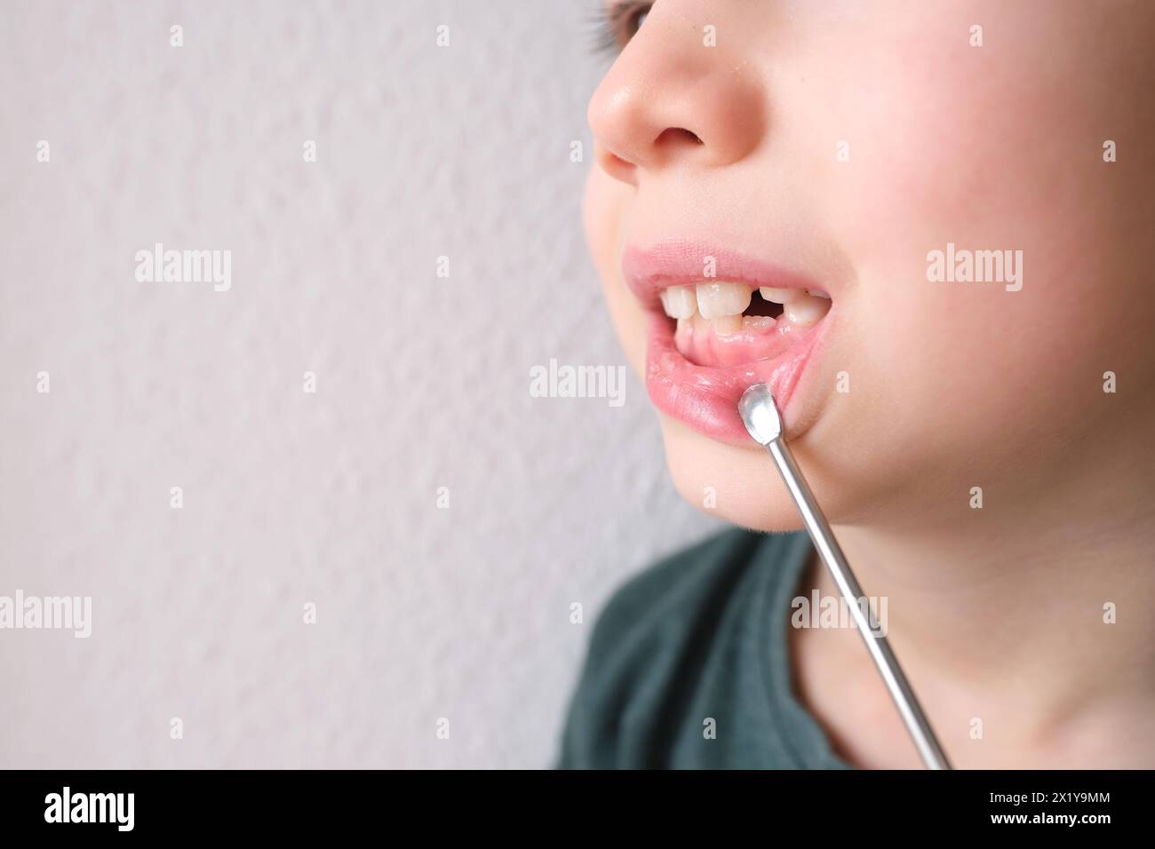 small child, kid 7-8 years old sits with open mouth, teeth close-up ...