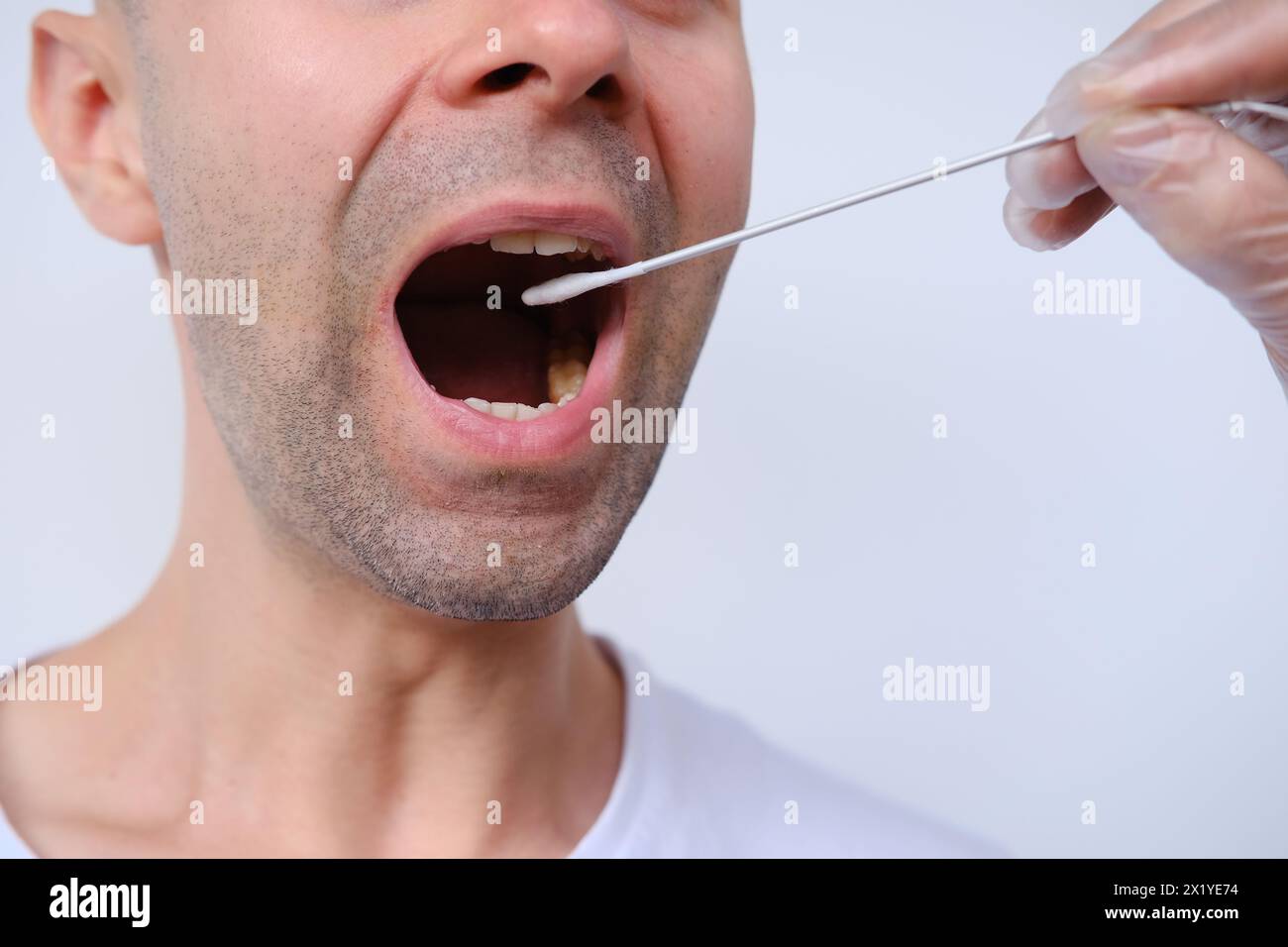 lab assistant takes a man’s saliva sample from his mouth for DNA ...