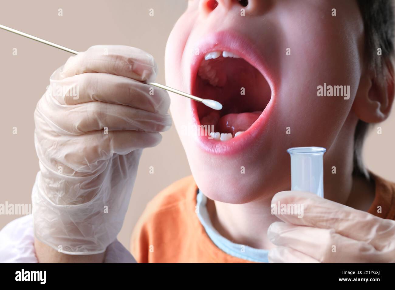 doctor takes a cotton bud from child’s mouth to analyze the saliva ...