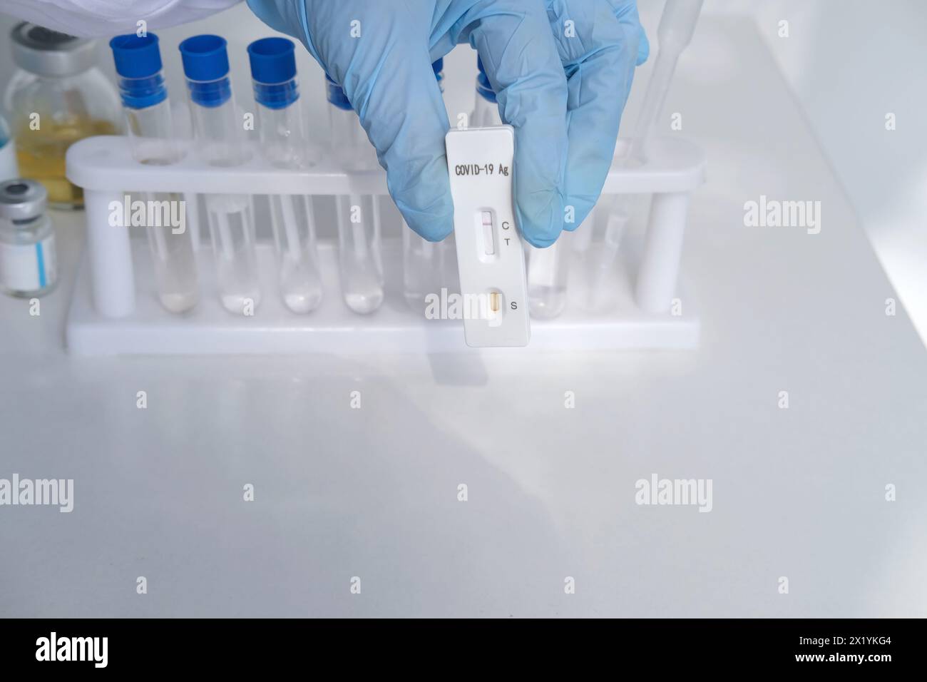 antigenic test cassette, glass test tubes with reagents, conducting a ...