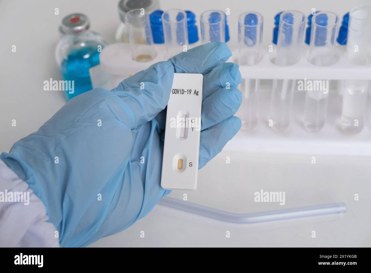 antigenic test cassette, glass test tubes with reagents, conducting a ...