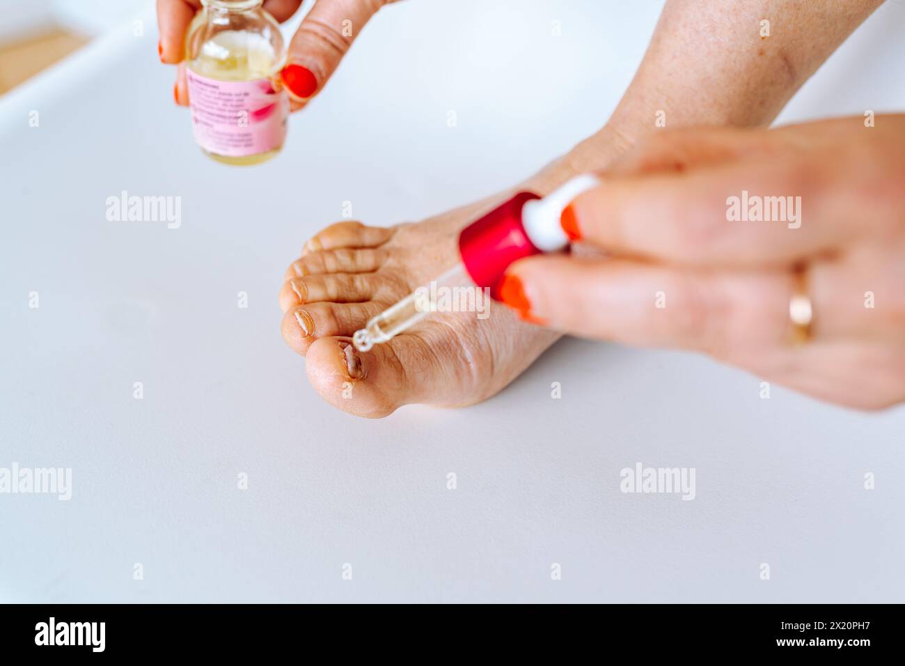 Applying oil with pipette to damaged toe nail Stock Photo - Alamy