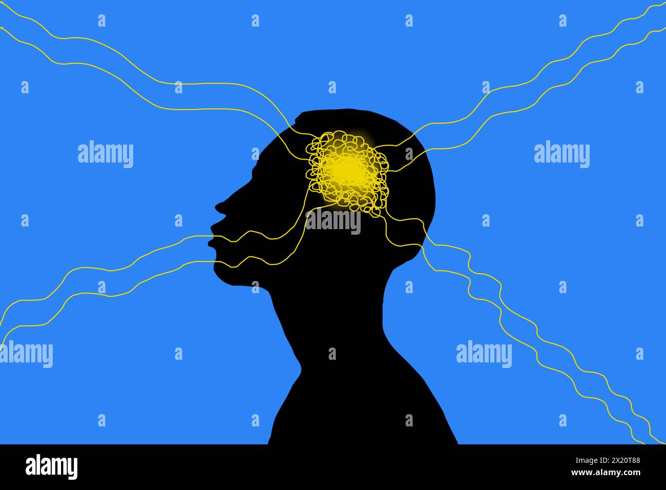 Brain anatomy electricity hi-res stock photography and images - Alamy