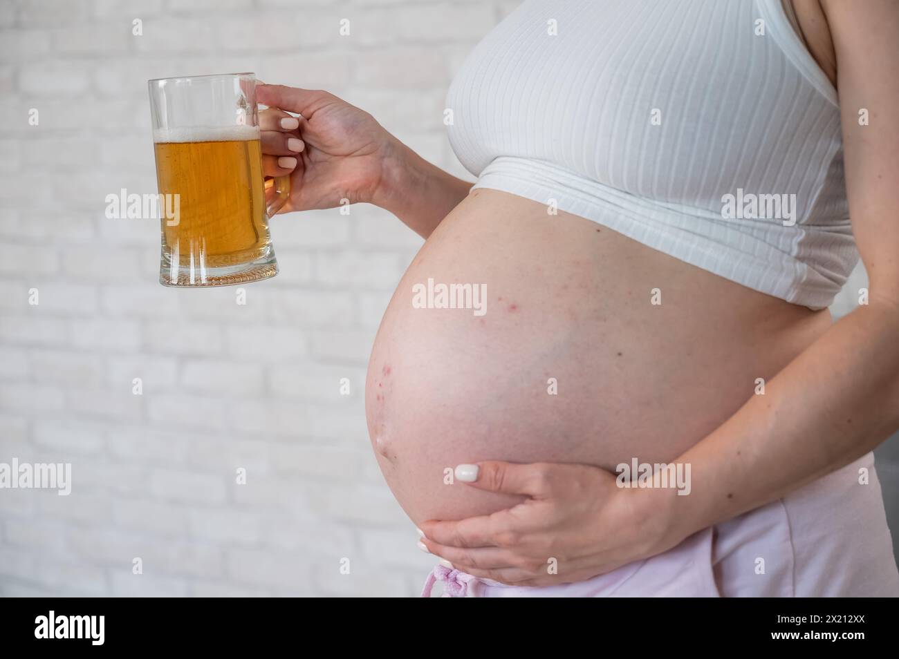 Faceless pregnant woman with rash on stomach holding glass of beer ...