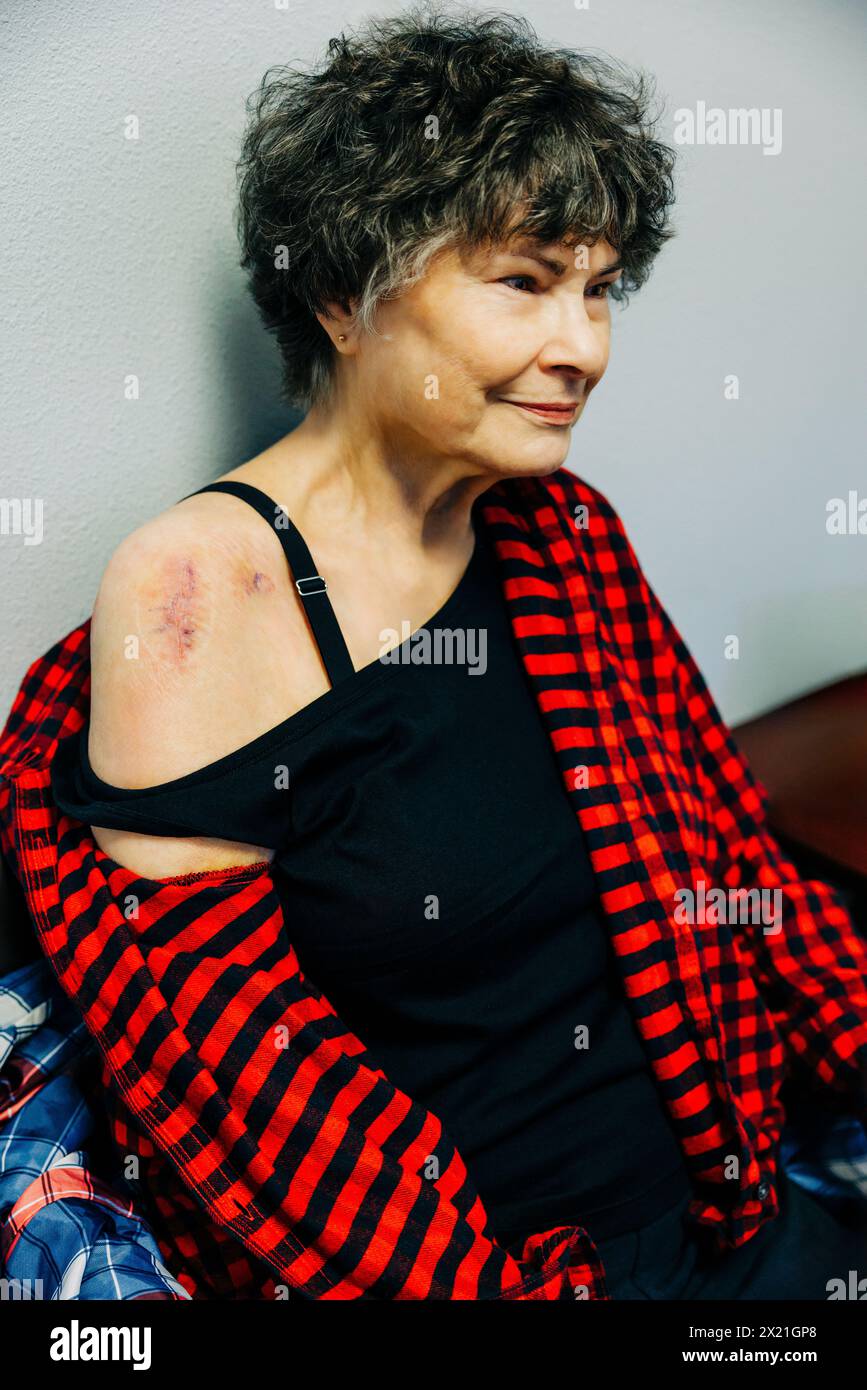 Surgery shoulder incision hi-res stock photography and images - Alamy