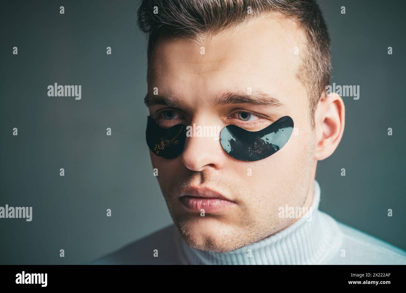 Man face with flakes under the eyes. Mans flakes. Patches under close ...