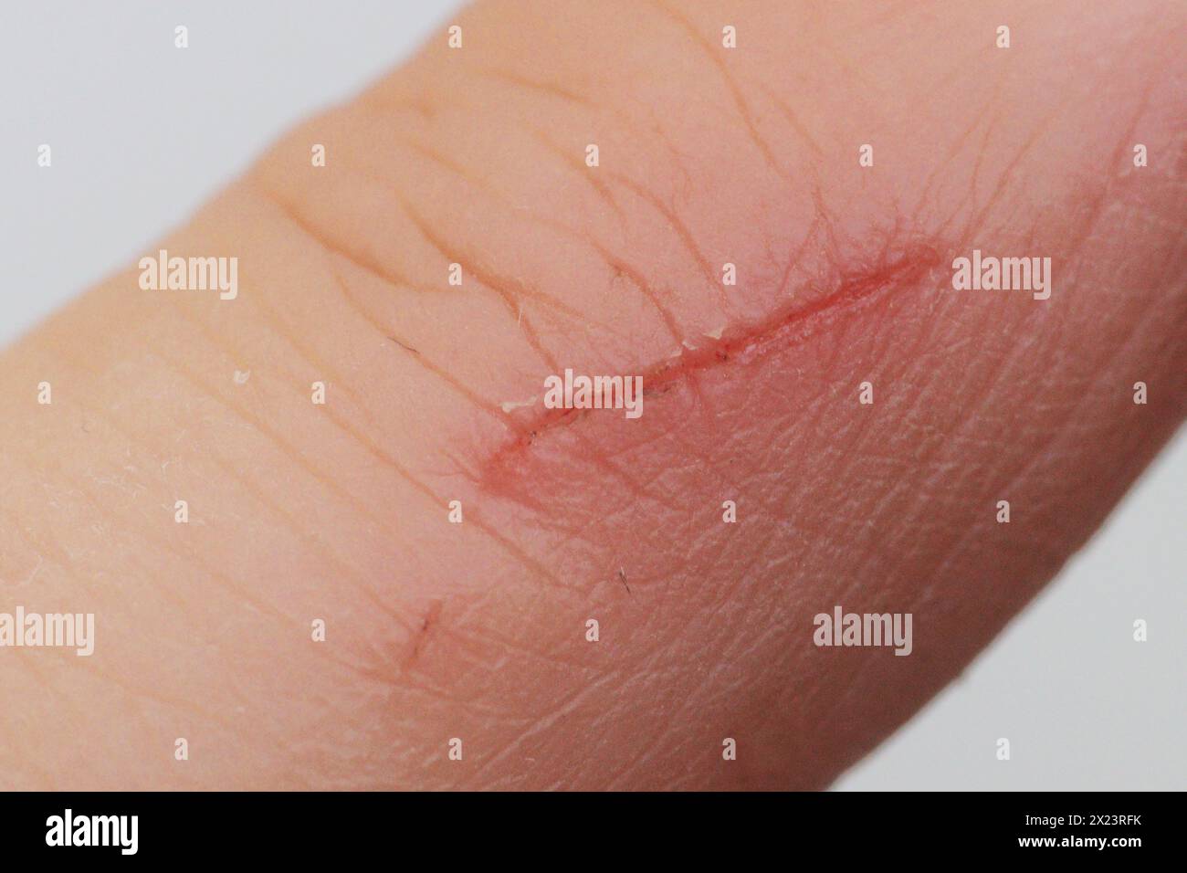Deep scratch hi-res stock photography and images - Alamy