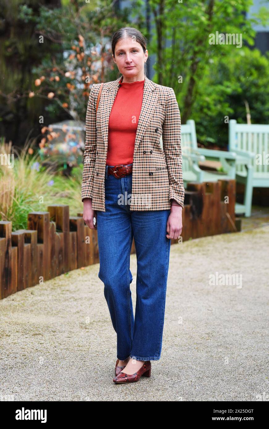 Former model Irena Stoynova, who almost died after trying to treat her ...