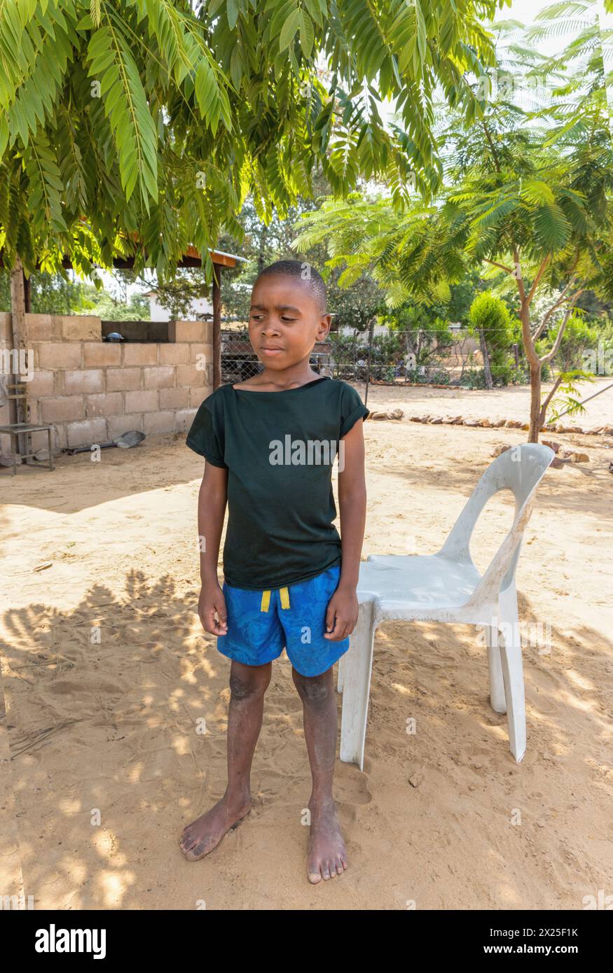 village african child ,standing in the yard, casual dressed Stock Photo ...