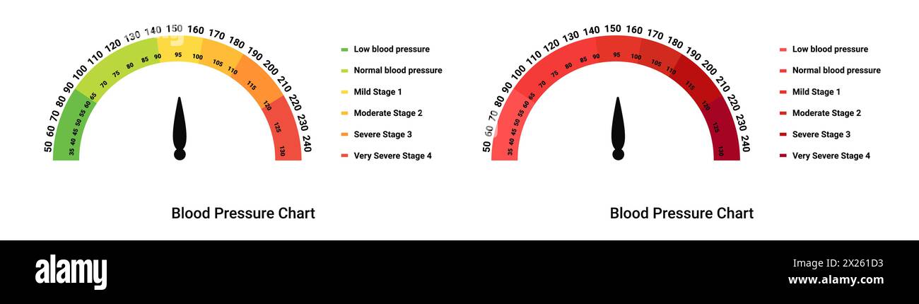 Blood pressure scale chart. Stage test with arrow and diagram ...