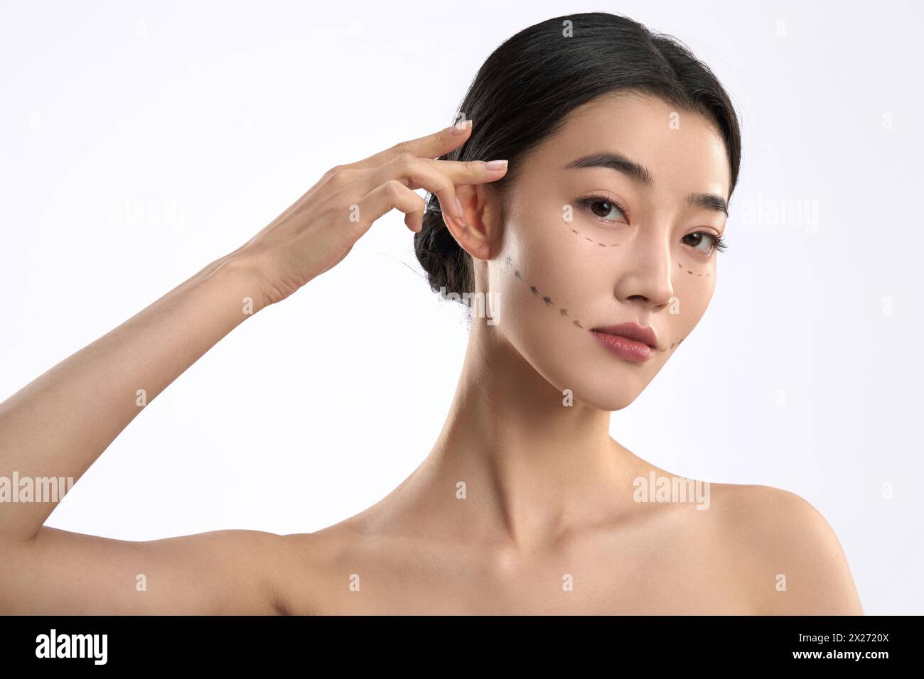 Young women undergoing facial contouring and cosmetic surgery Stock ...