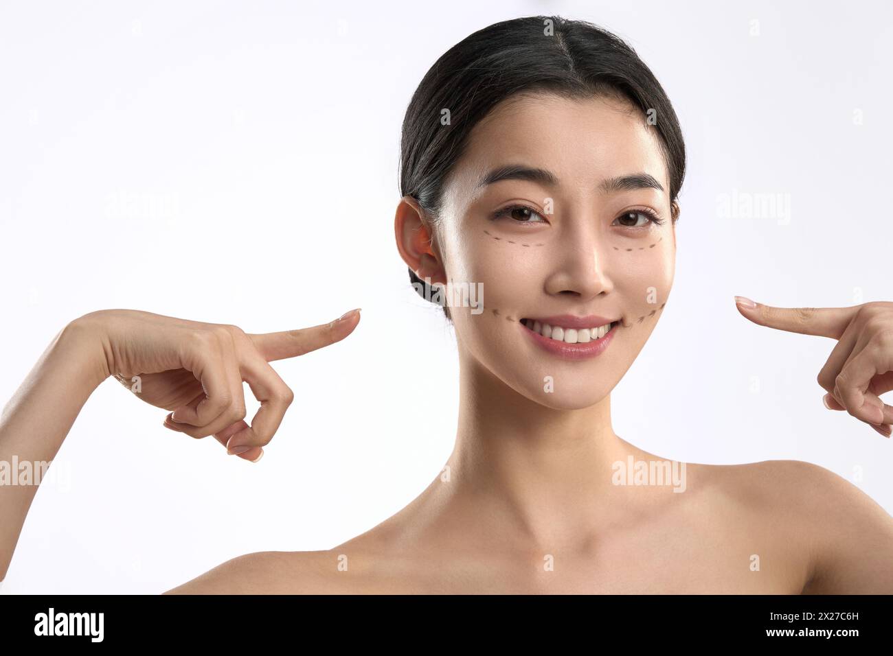 Young women undergoing facial contouring and cosmetic surgery Stock ...