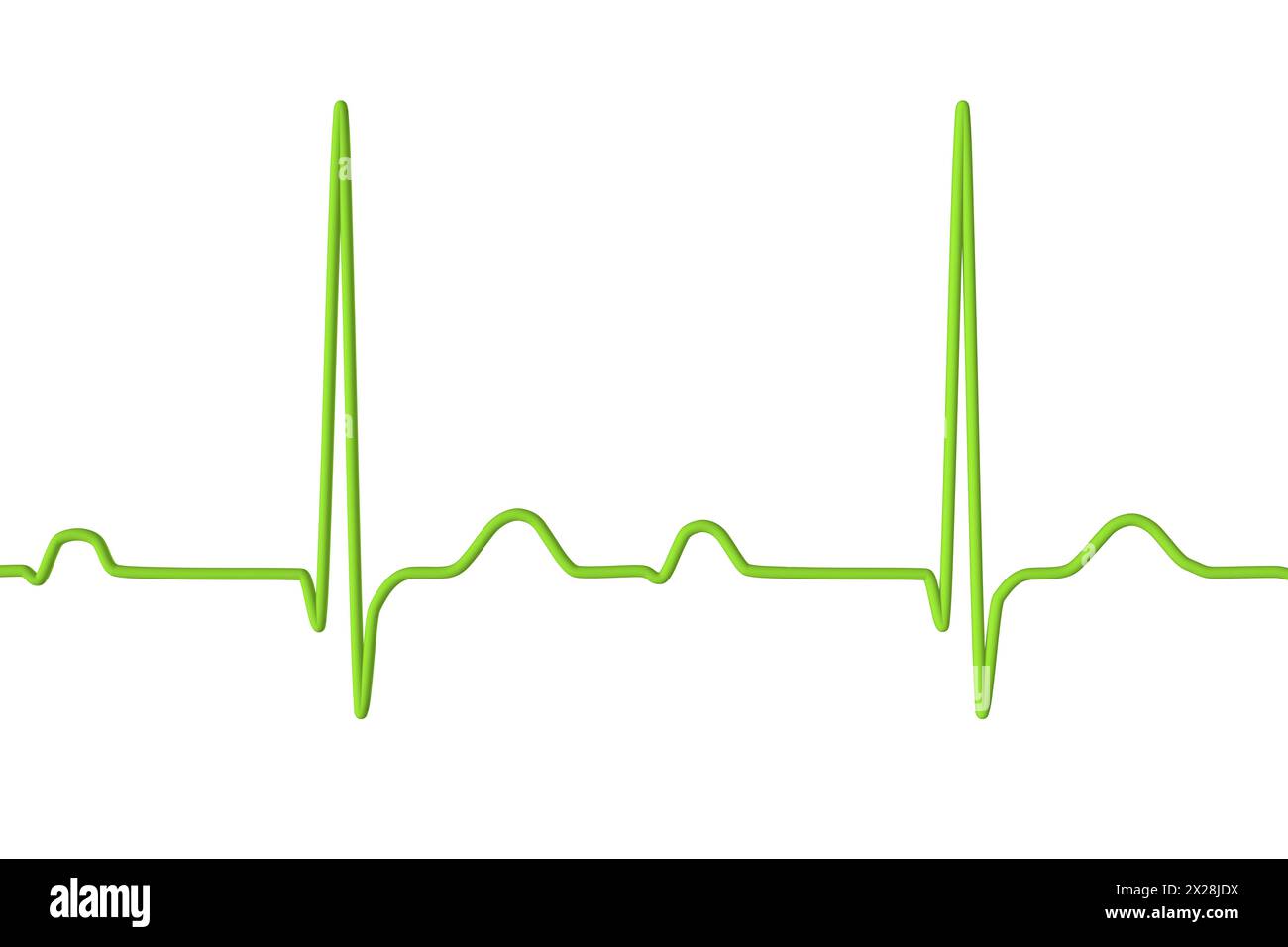 ECG displaying first degree AV block, illustration Stock Photo - Alamy ECG displaying first degree AV block, illustration Stock Photo - Alamy