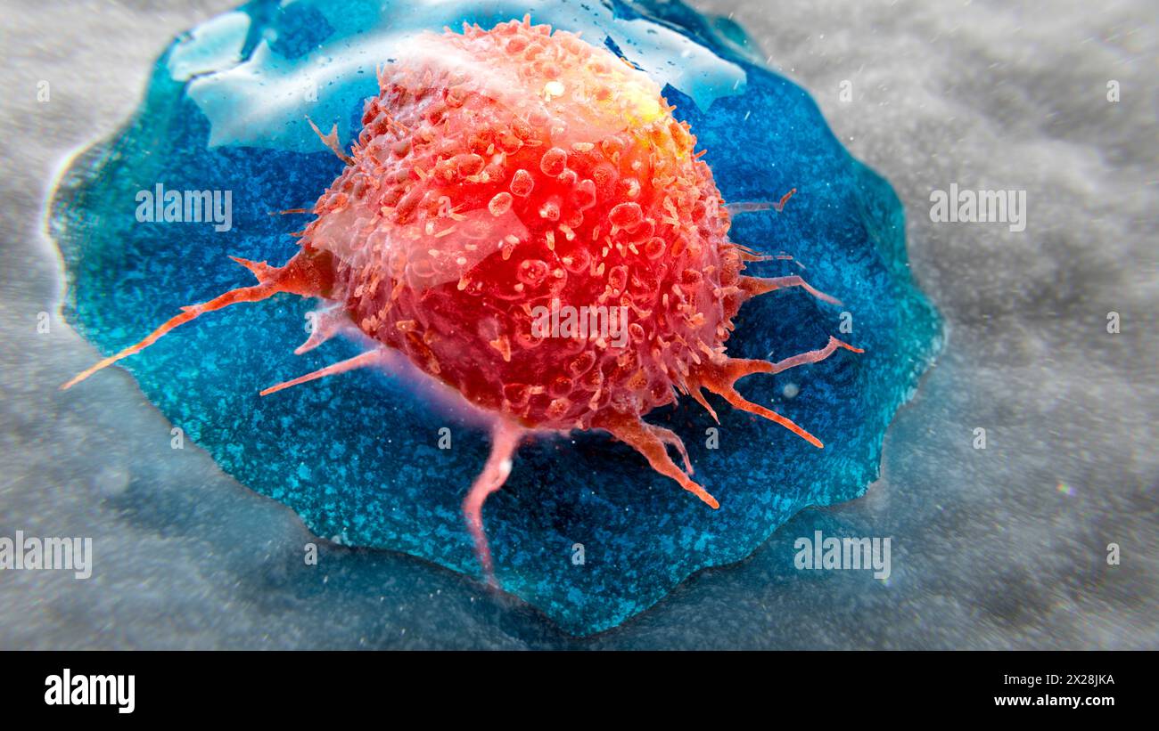 Hydrogel cancer therapy, illustration Stock Photo - Alamy