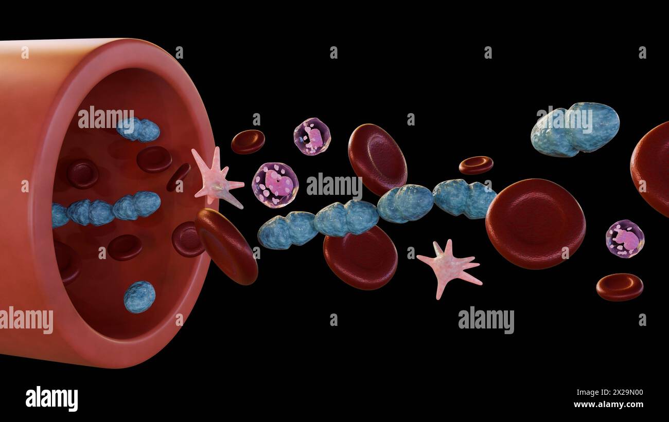 3d rendering of Septicemia, or sepsis, is the clinical name for blood ...