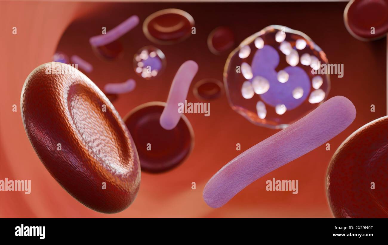 3d rendering of Septicemia, or sepsis, is the clinical name for blood ...