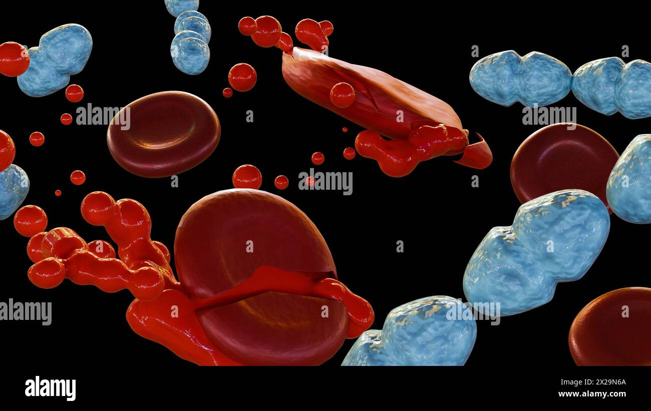 3d rendering of Septicemia, or sepsis, is the clinical name for blood ...