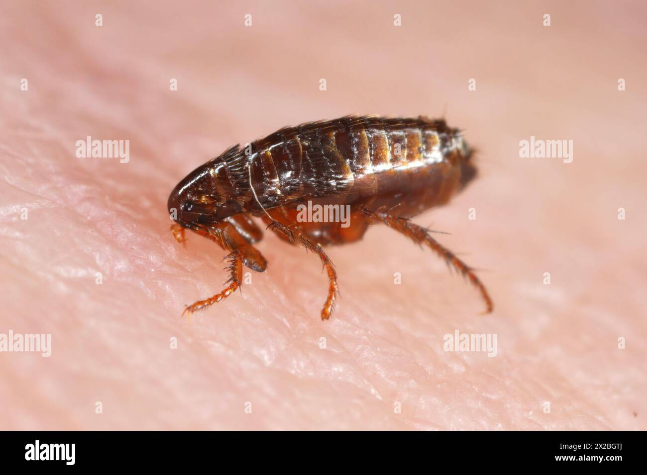 The flea feeds on human skin. Painful flea bite Stock Photo - Alamy