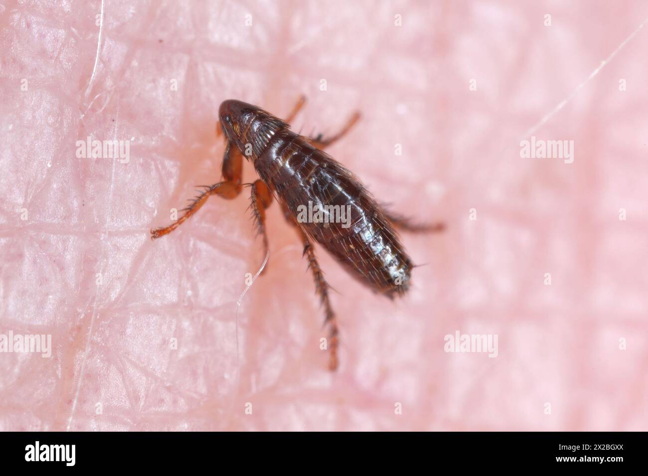 The flea feeds on human skin. Painful flea bite Stock Photo - Alamy