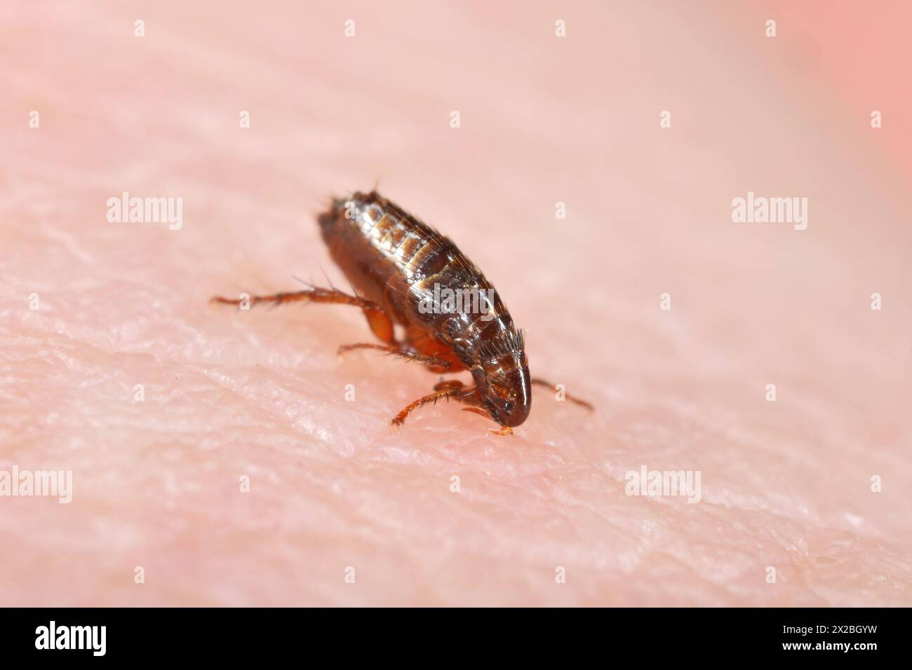 The flea feeds on human skin. Painful flea bite Stock Photo - Alamy