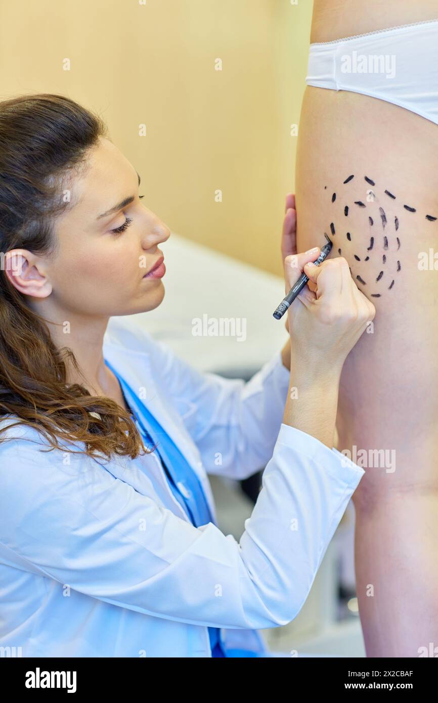 Liposuction. Liposculpture. It consists of aspiration cannulae of body ...