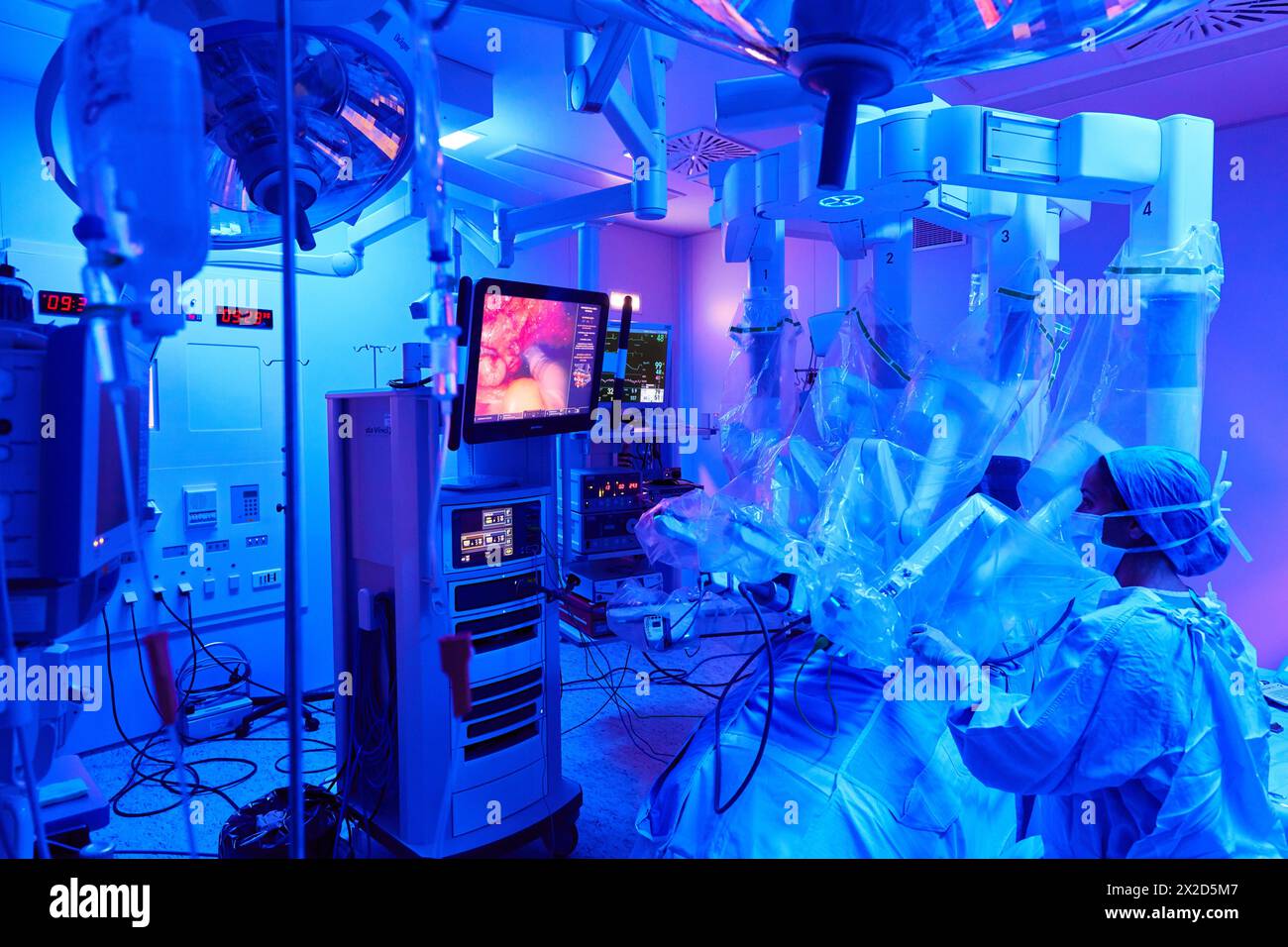 Surgical Treatment of Prostate Cancer, Radical prostatectomy, Da Vinci ...