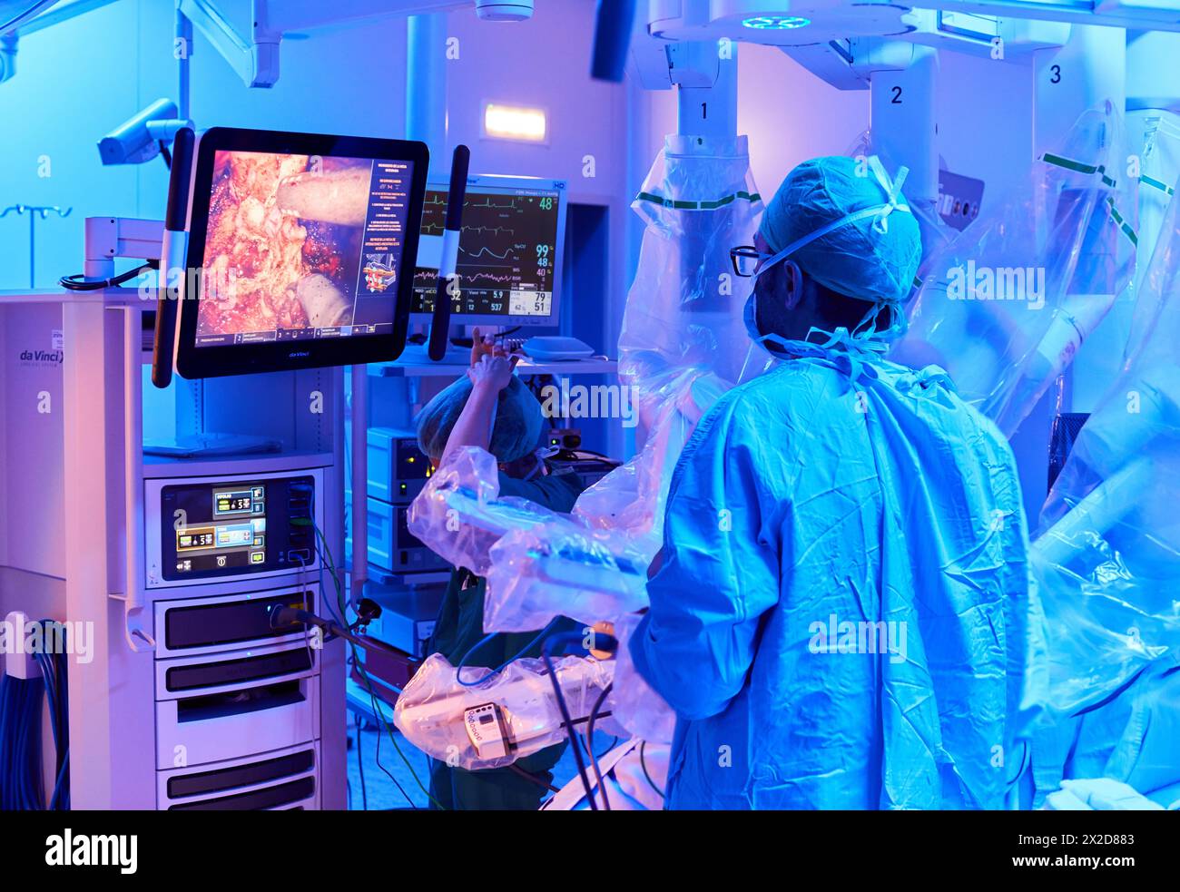 Surgical Treatment of Prostate Cancer, Radical prostatectomy, Da Vinci ...