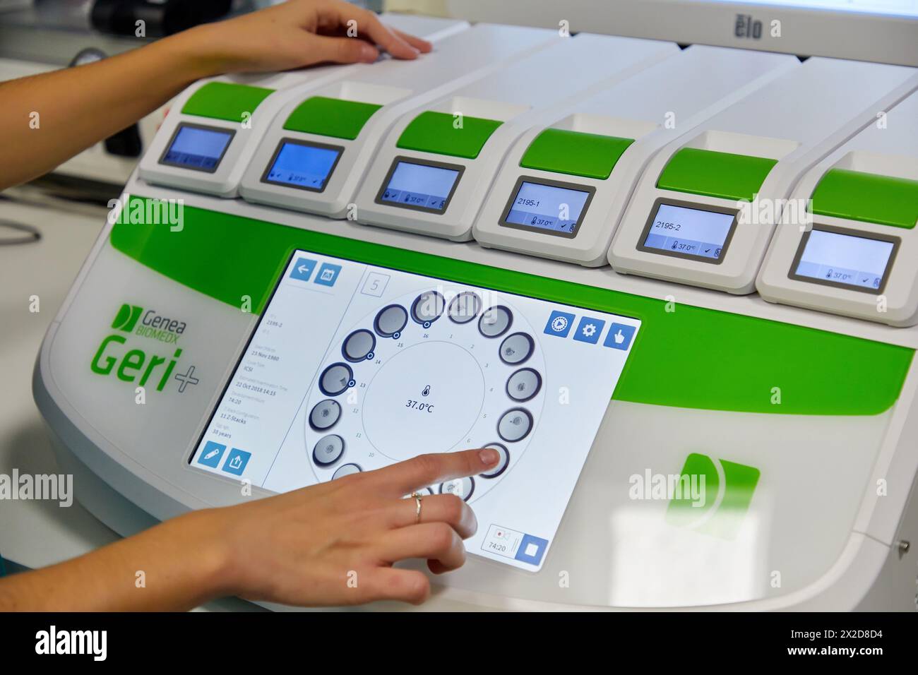 Geri +, EEVA System, Embryo Early Viability Assessment Test, Embryology ...