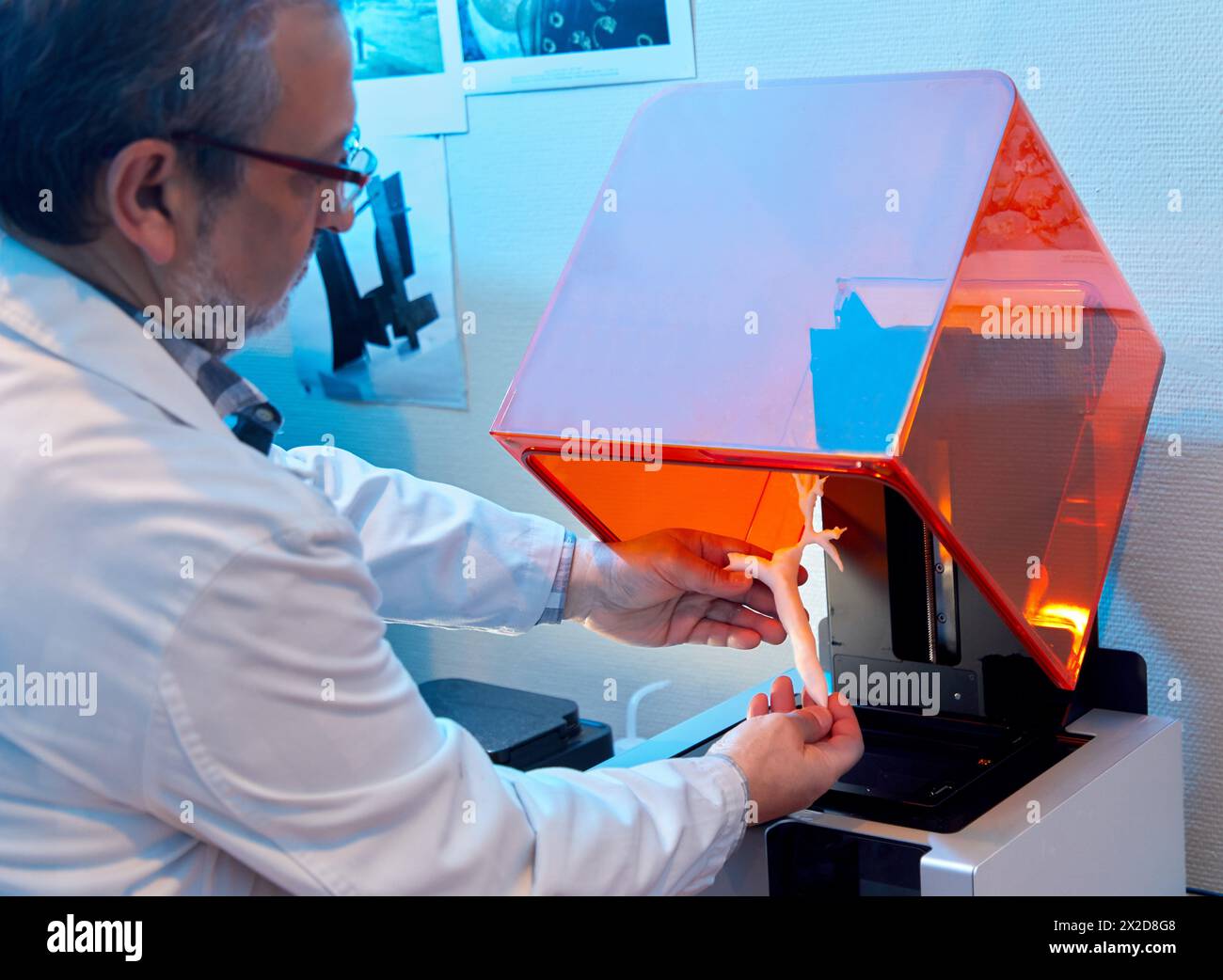 3D impression of the trachea of a patient from a medical image, 3D ...