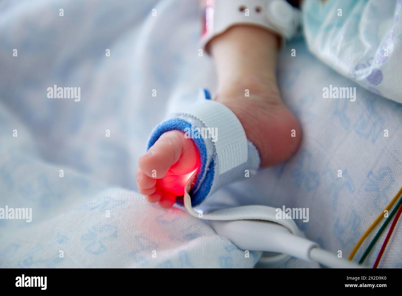 Neonatal intensive care unit foot hi-res stock photography and images ...