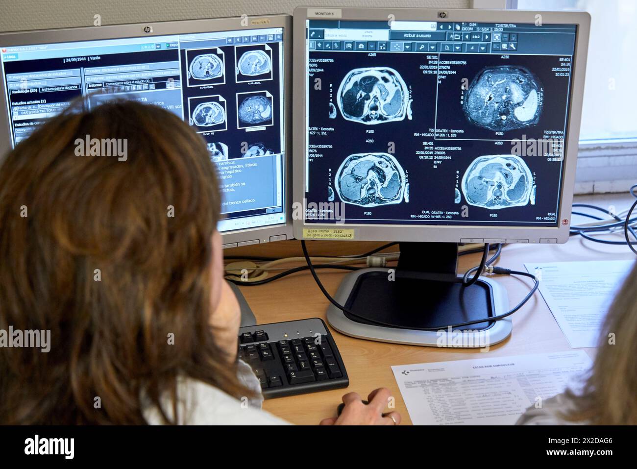 Committee of tumors hi-res stock photography and images - Alamy