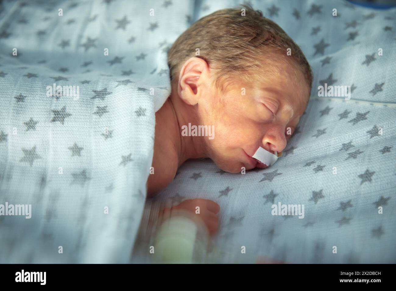 Hospitalized baby, Neonatal pediatrics, Medical care, Neonate Intensive ...